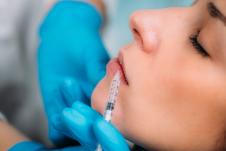 Lip Dermal Filler Treatment - Tonbridge Skin Clinic