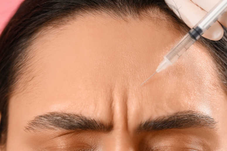 Frown and Forehead Lines Dermal Filler Treatment in Tonbridge, Kent ...